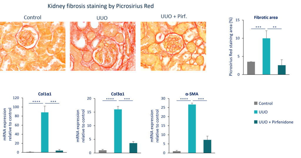 UUO Model - Unilateral Ureteral Obstruction model for Renal Fibrosis